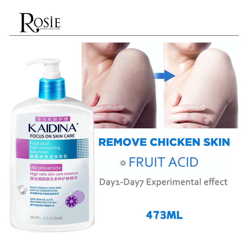 Skin Bleaching Brightening Lotion Niacinamide |Fruit Acid Essence body ...