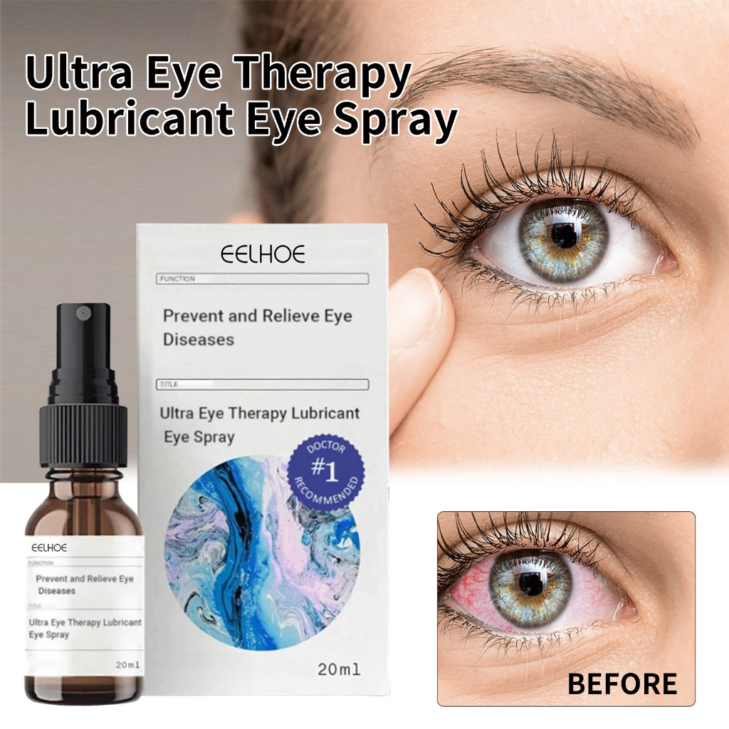 EELHOE Eye Care Lubricating Spray Relieve Fatigue Treating Red Disease ...