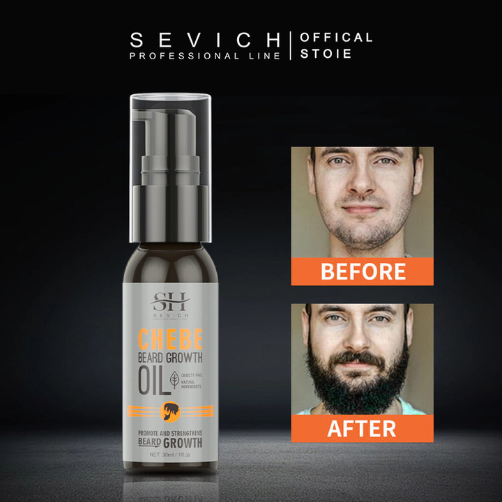 SEVICH Natural Chebe Beard Growth Oil Effectively Promotes Beard Growth ...