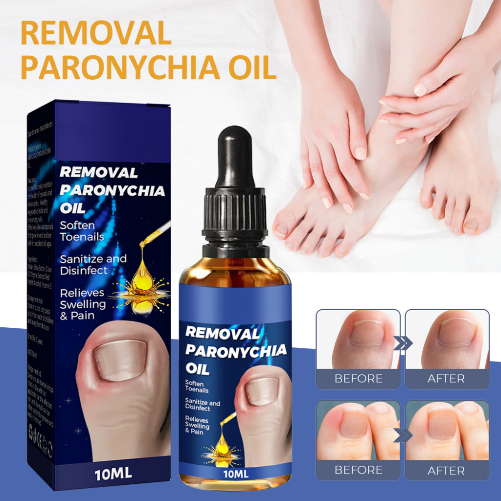 Paronychia Removal Oil Ingrown Toenail Treatment Toe Fingernail Repair ...