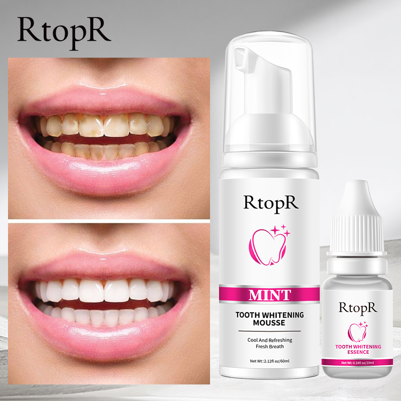 RtopR Teeth Whitening Set Teeth Whitening Mousse Remove Plaque Stains ...
