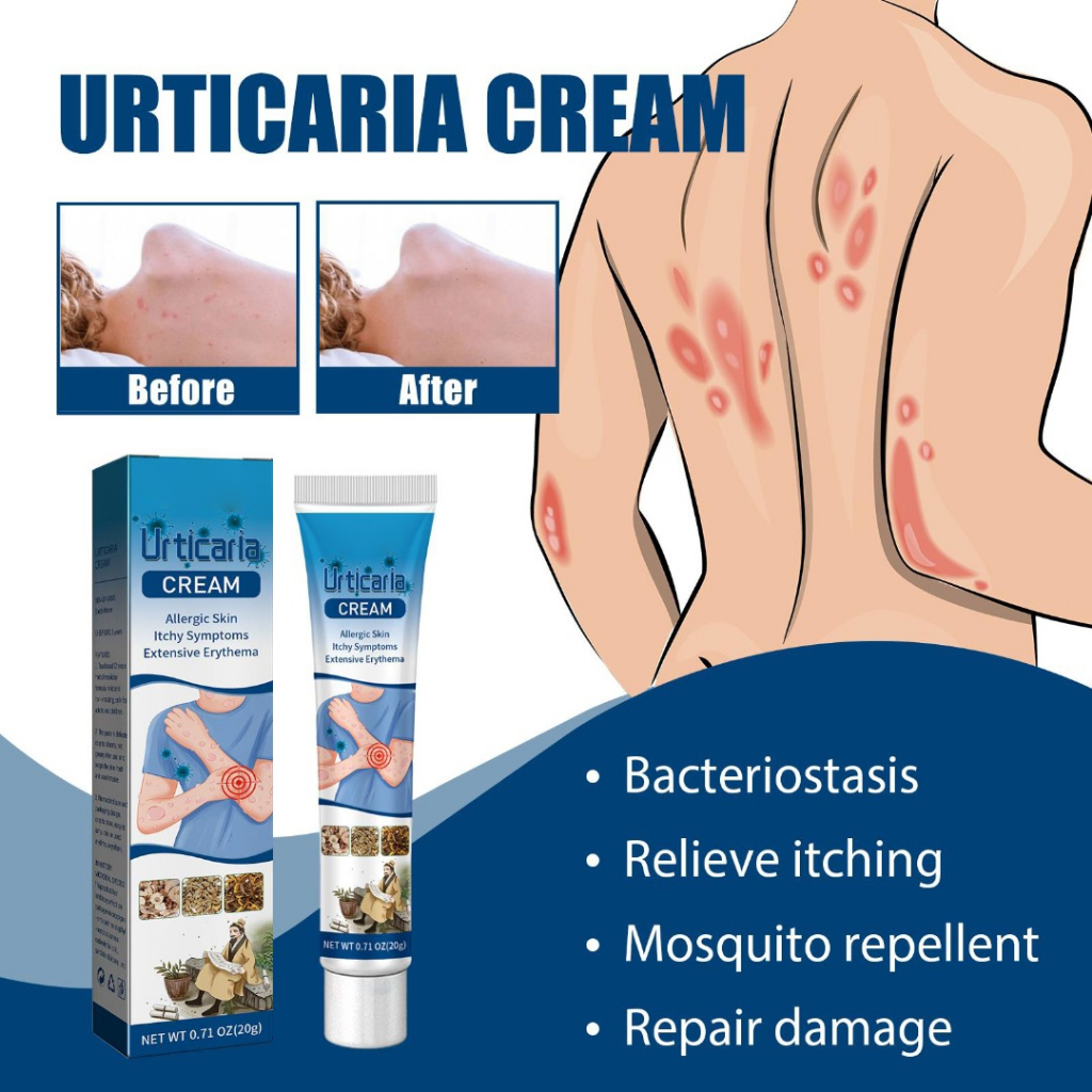 Herbal Antibacterial Itching Cream Skin Rash Urticaria Treatment Care Shopee Philippines