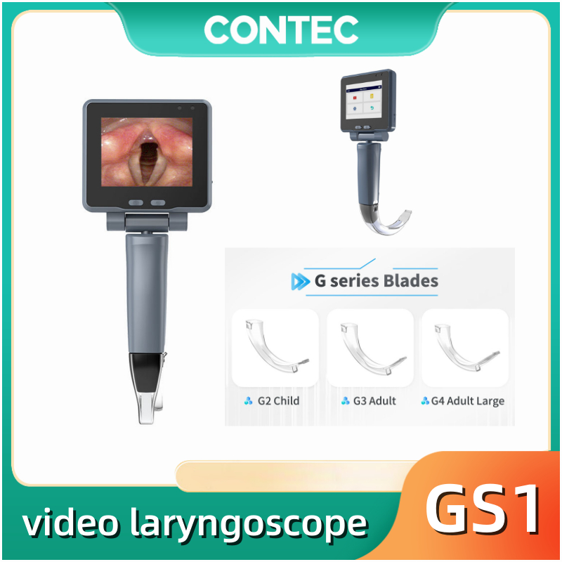 CONTEC Digital Video Laryngoscope smartscope VL pro CMS-GS1 | Shopee Philippines