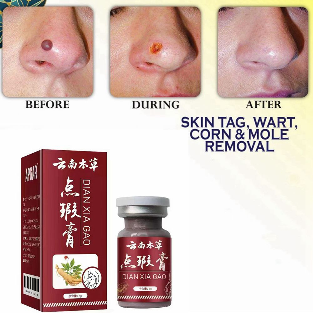 APGAR Concentrated Potent Skin Tag Removal Cream Body Warts Removal ...