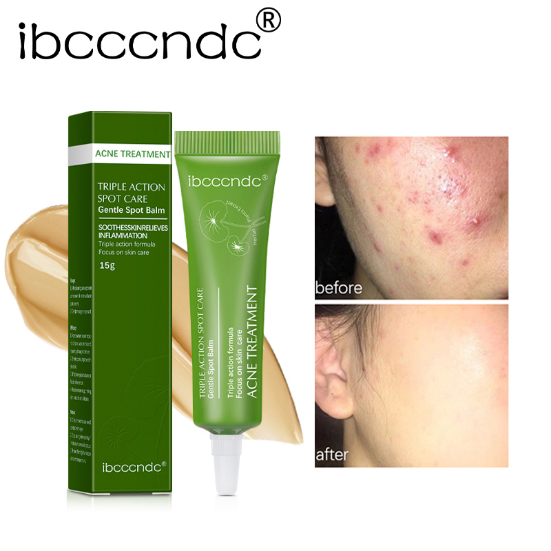 IBCCCNDC Acne Plus Triple Action Spot Care Balm Anti Scar Pimple Eraser ...