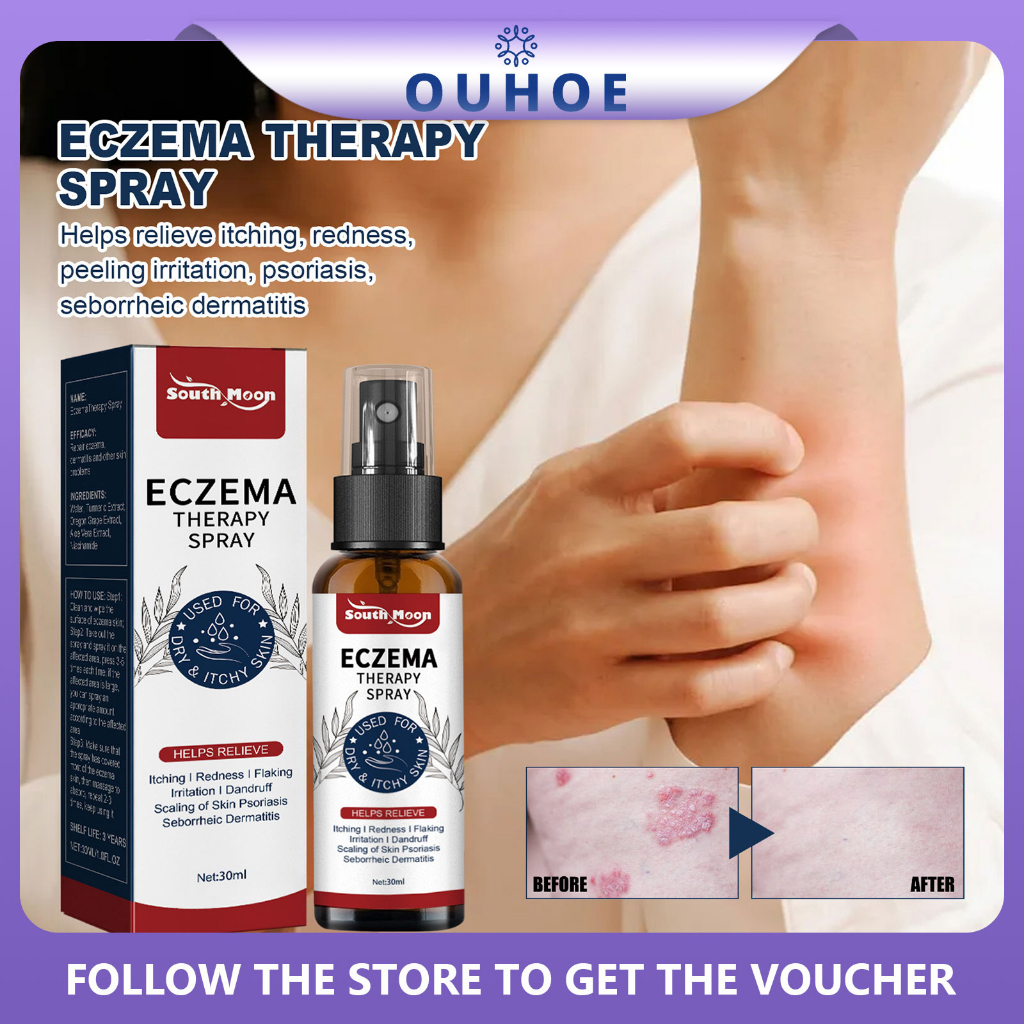 Psoriasis Relief Spray Improve Redness Dermatitis Hand Foot Scalp ...