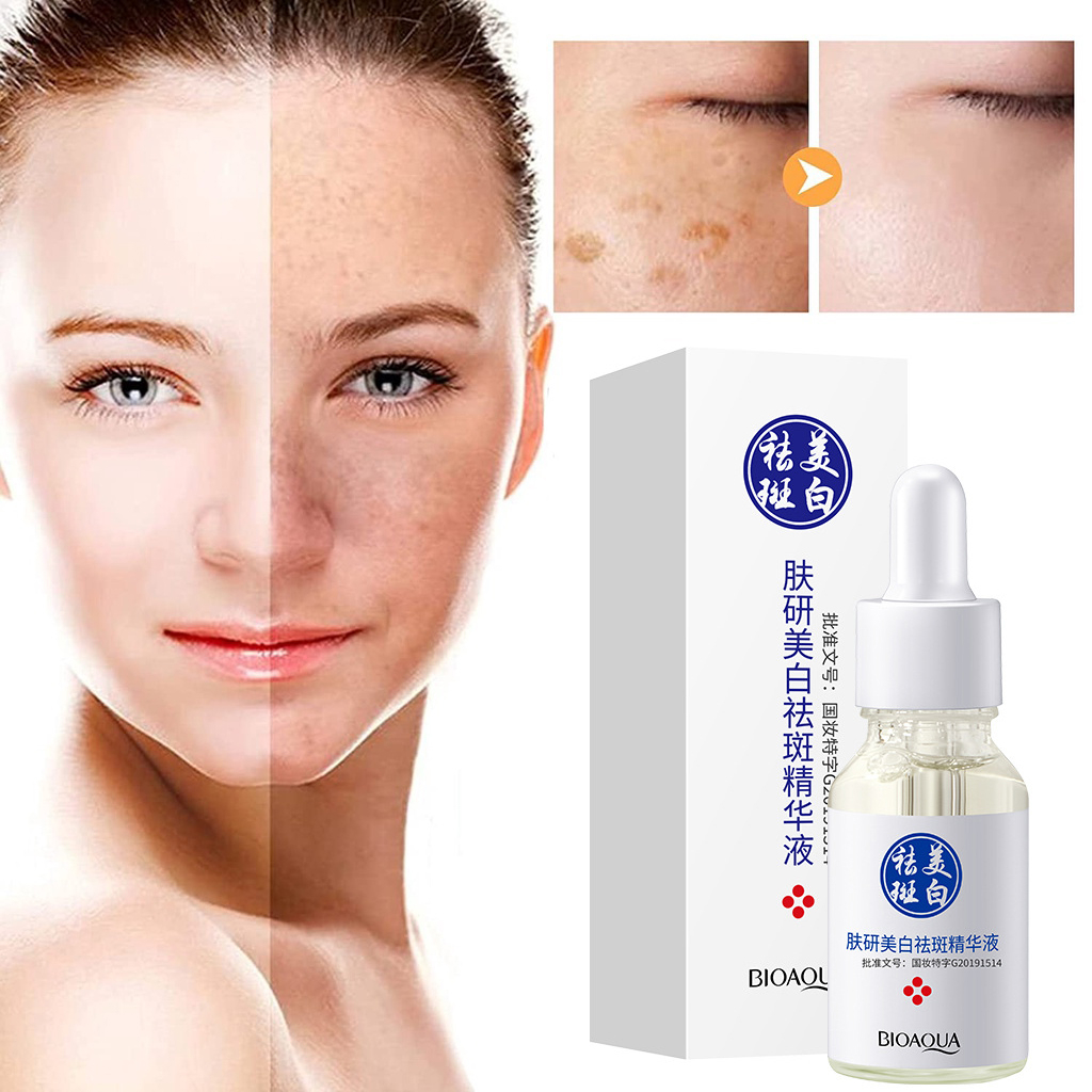 BIOAQUA Anti Freckle Whitening Serum Brighten Skin Care Fade Dark Spots Freckles Serum Remove ...