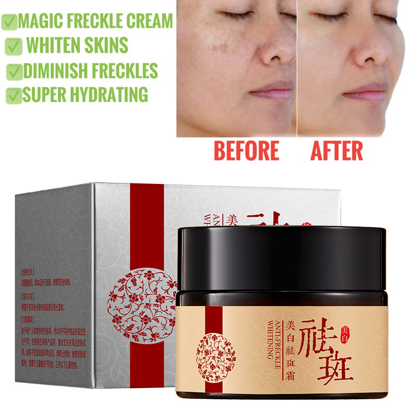 BIOAQUA Herbal Anti Freckle Whitening Face Cream Skin Brighten ...