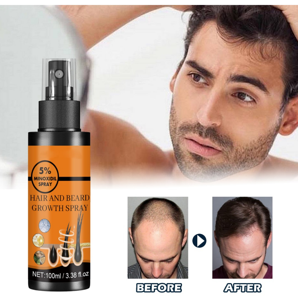 5% Minoxidil Hair Growth Spray For Men Women 100ml Hair Regrowth ...