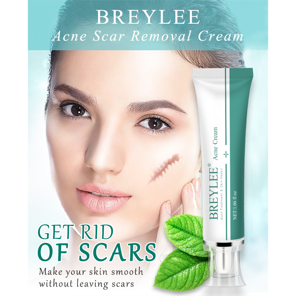 BREYLEE Scar Removal gel 30g，Skin Repair Scar Acne Treatment Remove Stretch Marks Whitening ...