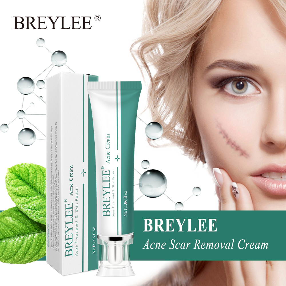 BREYLEE Acne Scar Removal Cream Fades Acne Marks Fade Scar Melanin ...