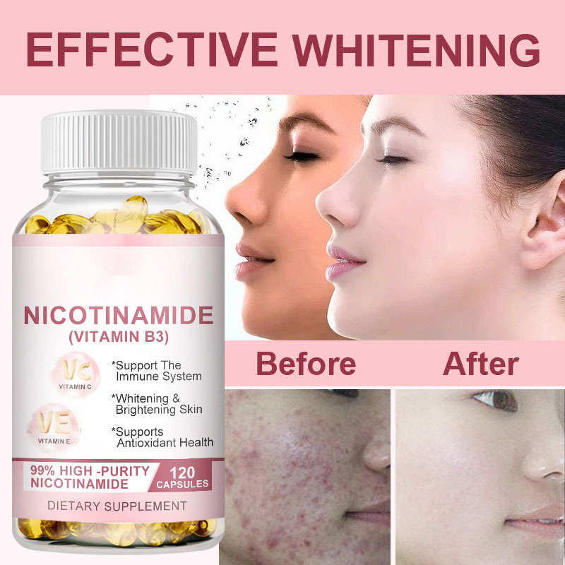 Nicotinamide Whitening Capsule With Vitamin B3 Antioxidant brightens ...
