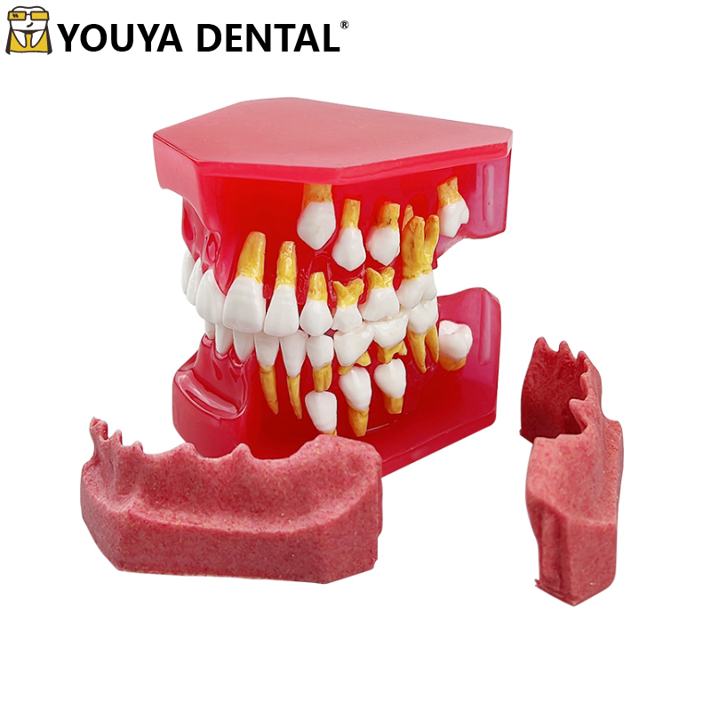 Resin Children Primary Permanent Tooth Model Alternative Deciduous ...