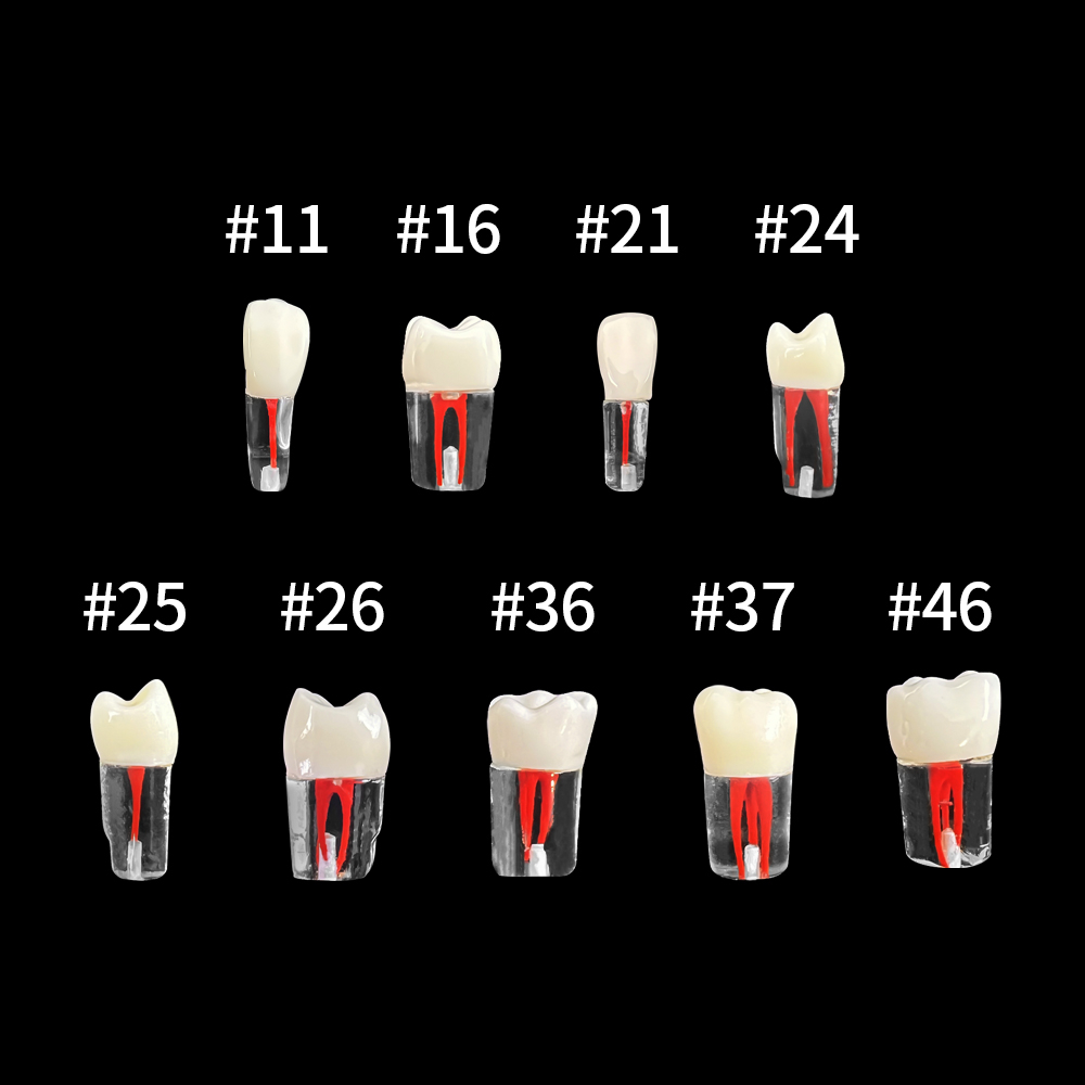 ENDODONTIC TEETH MODEL Dental Tooth Model Root Practice Pulp Cavity ...