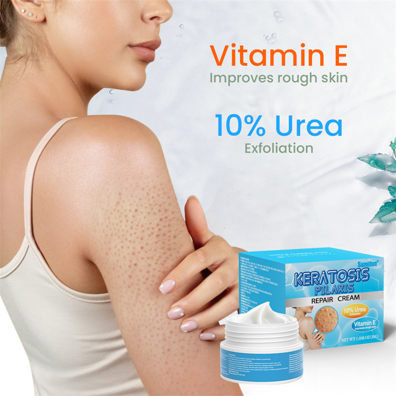 Body Whitening Cream Vitamin E Curing Keratosis Pilaris Chicken