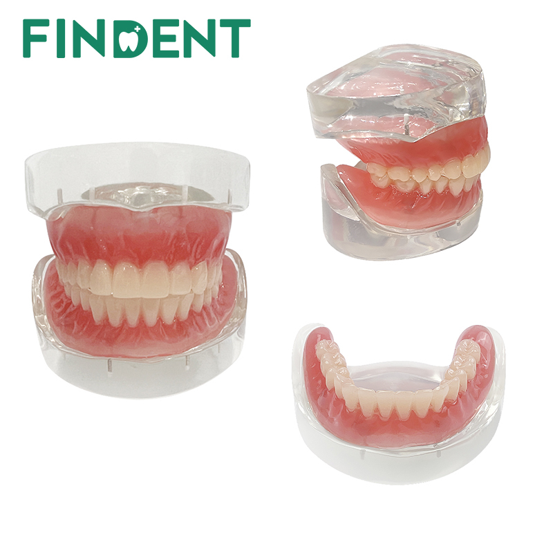 Dental overdenture model Magnetic attachment Removable maxillary and ...