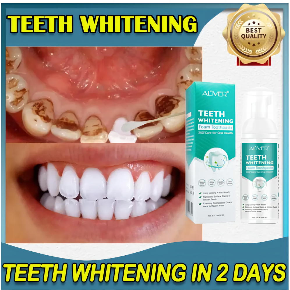 ALIVER Teeth Whitening Mousse Toothpaste Cleansing teeth Mousse Remove ...