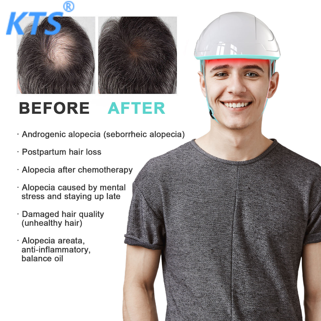 Kts Wireless Hair Growth Cap 109pcs Laser Diodes Lllt Laser Therapy