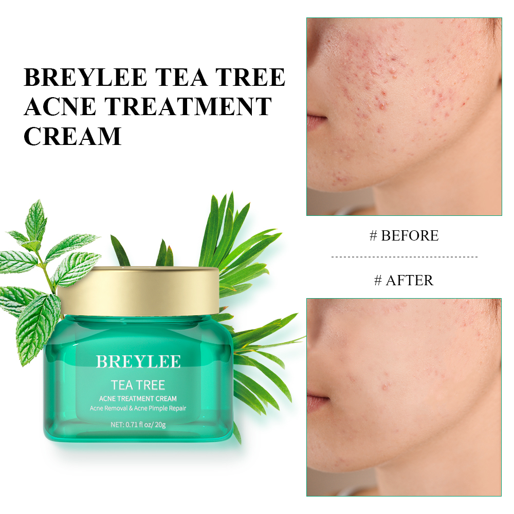 BREYLEE Acne Treatment Tea Tree Extract Cream Soothes facial redness and anti-inflammatory 20g ...
