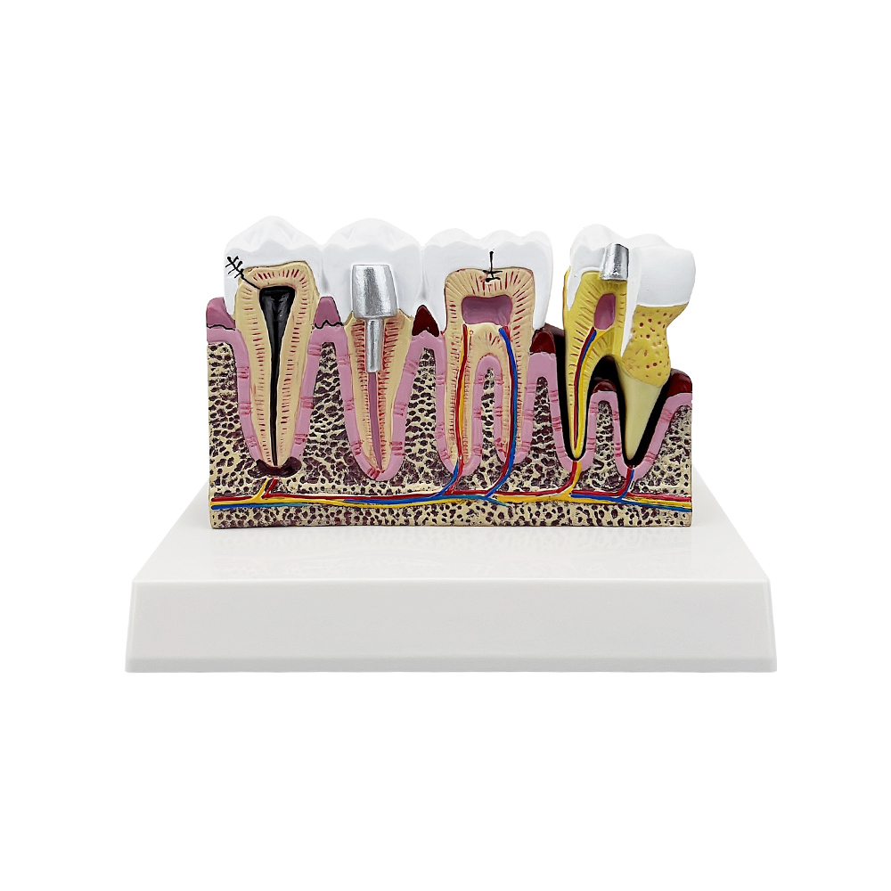 Standard Dental Oral Teeth Anatomical Teaching Model Comprehensive ...