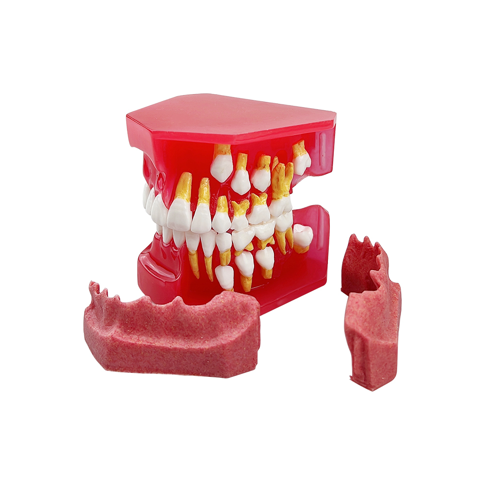 Dental Model Resin Children Primary Permanent Tooth Model Alternative ...