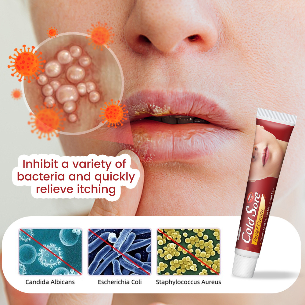 Cold Sore Relief Cream Cheilitis Lips Relief Cream Repair lip Dry ...
