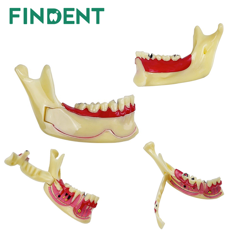 Dental Endodontic Treatment Model Right Side Mandible Tissue Anatomical ...
