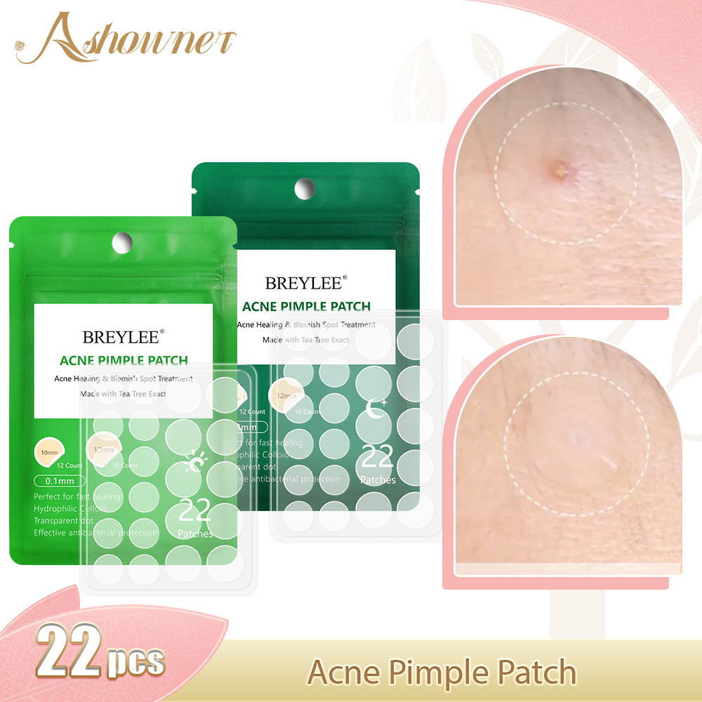 Acne Pimple Patch Stickers Acne Treatment Pimple Remover Tool Blemish ...