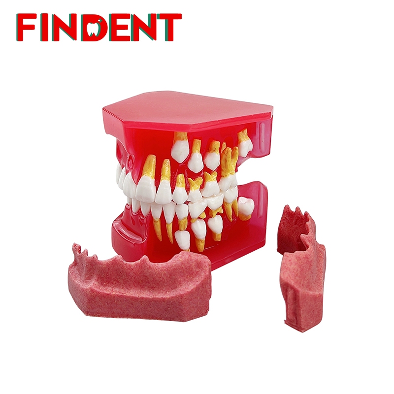 Dentalmall Teeth Typodonts Dental Model Teeth Eruption Development ...