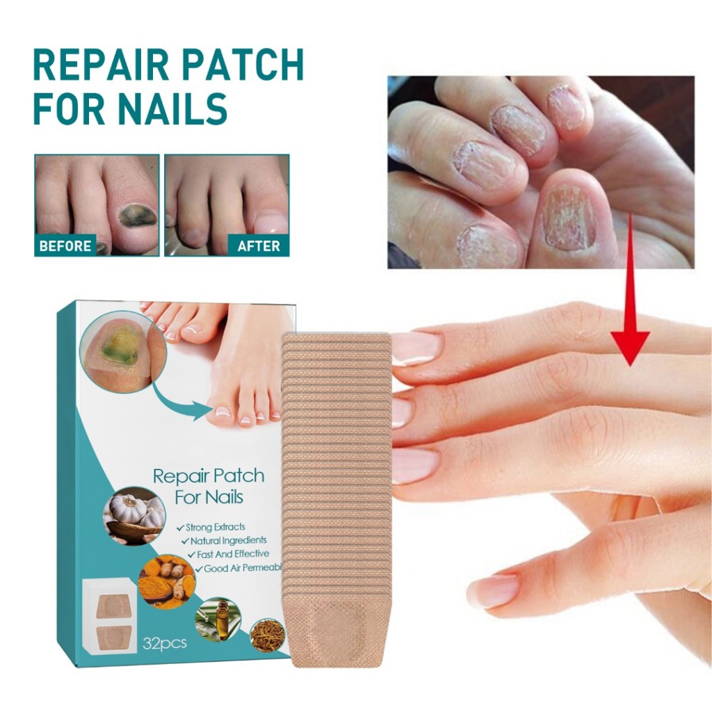 1box Fungus Finger Toe Nail Repair Stickers Fungal Nail Repair Patches ...