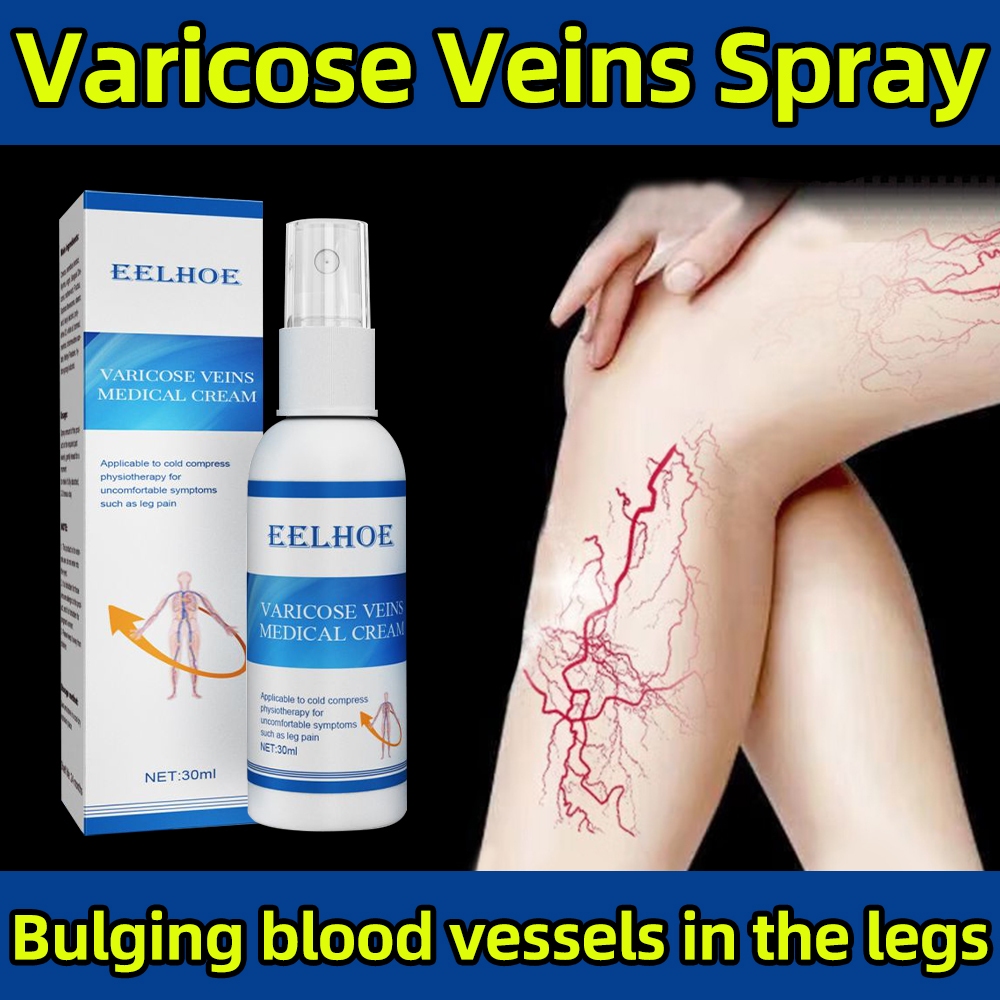 EELHOE Varicose Vein Removal Spray Spider Vein Pain Relief Spray ...