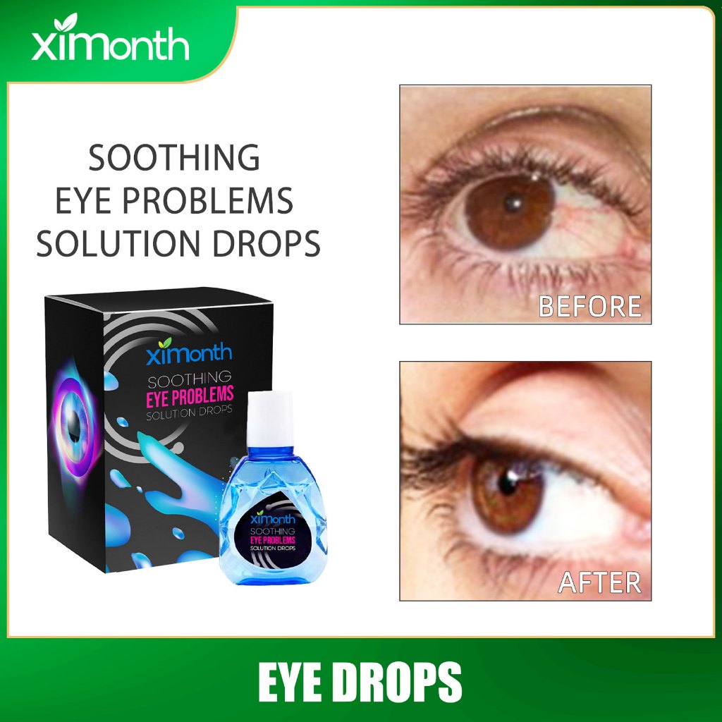 Ximonth Eyes Soothing Drops 10ml Relieve Eye Fatigue Dryness Redness ...