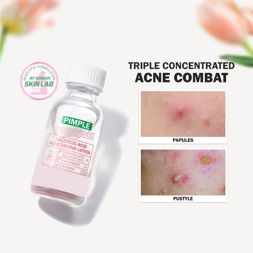barenbliss BNB Pimple Warrior Salicylic Acid Acne Drying Lotion Triple ...