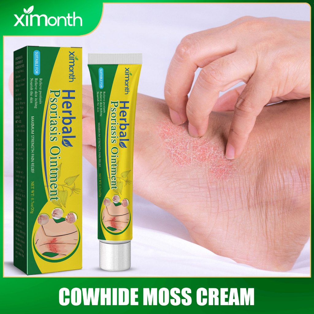 Ximonth Psoriasis Ointment Eczema Ointment 20g Dermatitis Eczematoid ...