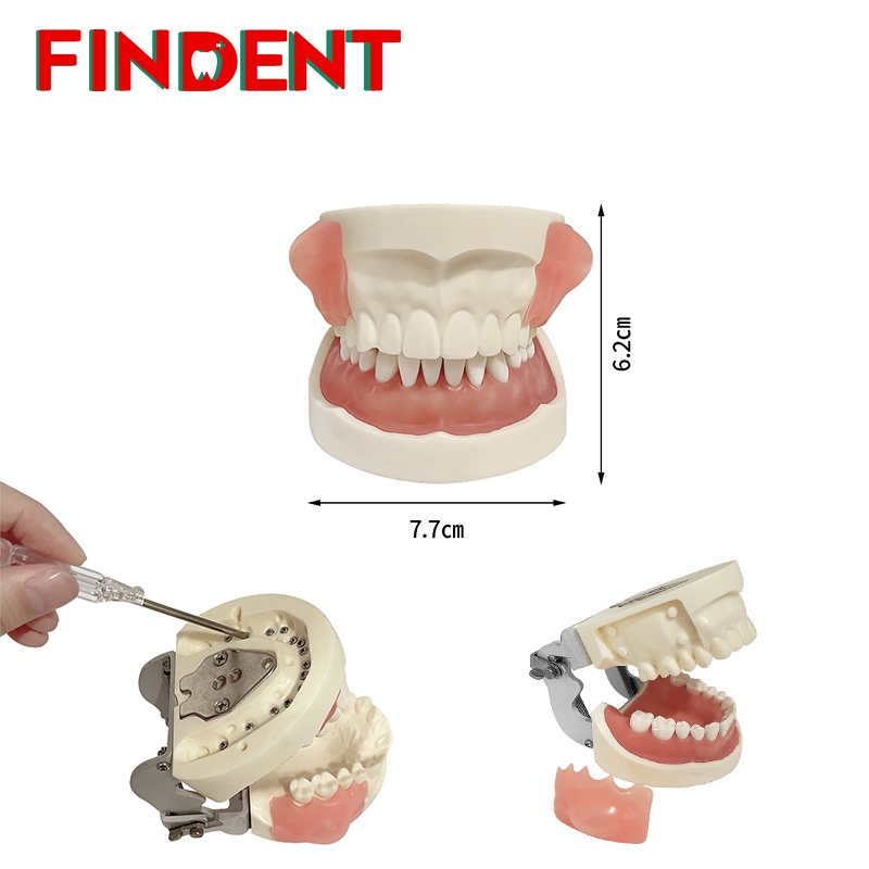 Dental Model Teeth For Preparation Abscess Incision And Drainage Teeth ...