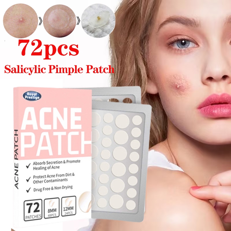 72PCS/BOX Salicylic Acne Pimple Patch Waterproof Acne Remover ...