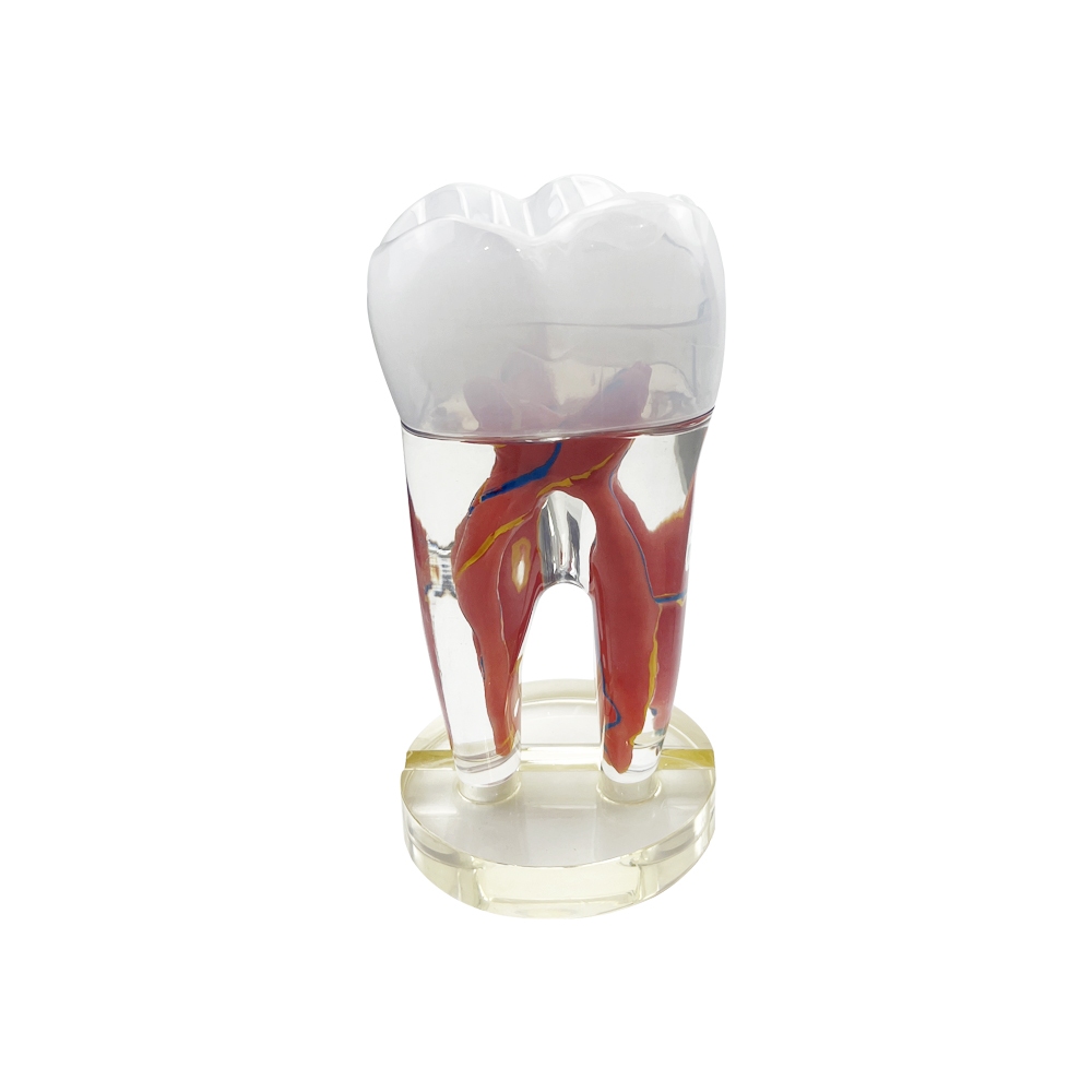 Detachable Models Endodontic 10 Times Dental Model Large Clear Tooth ...
