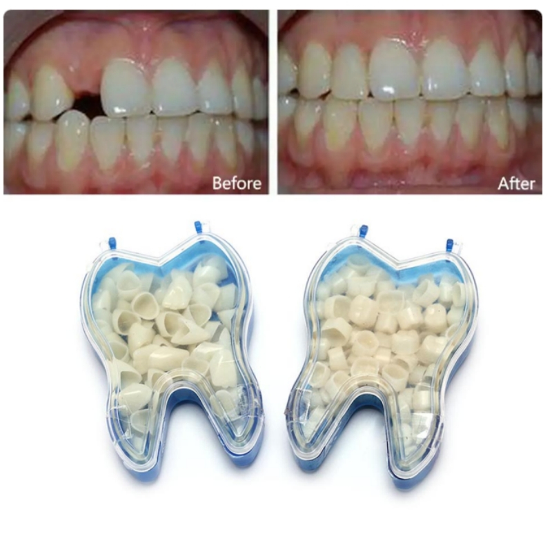 2 Box Dental Temporary Crowns Resin Porcelain Materials Anterior Teeth ...