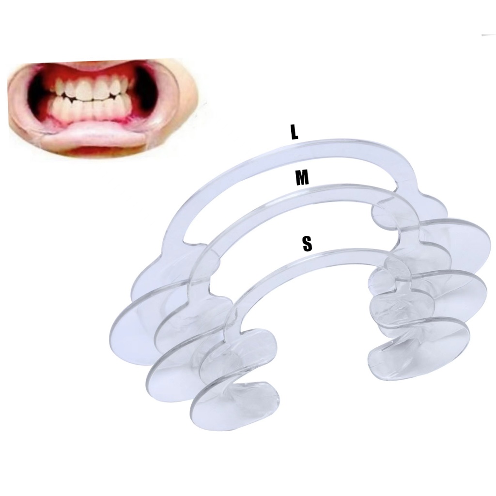 10Pcs Dental Oral Cheek Teeth Retractor Mouth Opener Wide Lips Holder ...