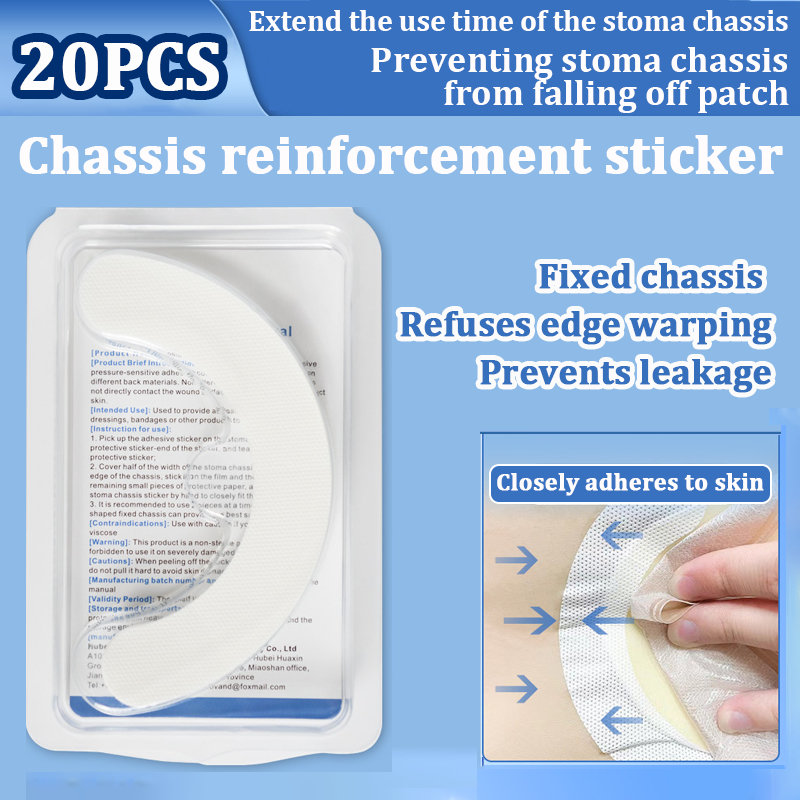 Ostomy bag pressure-sensitive tape reinforcement strip //Chassis ...