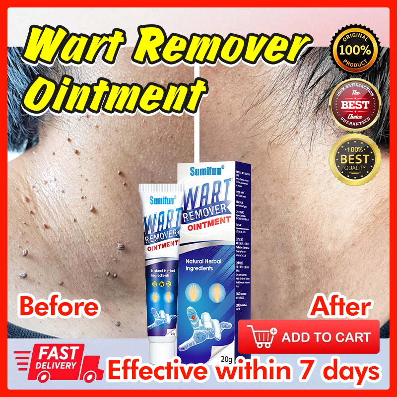 Safe & Effective Warts Remover Cream Original Be Suitable Genital gamot ...