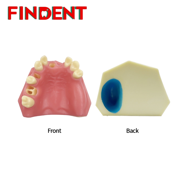 Dental Implant Practice Model Mandibular sinus With Soft Gums for ...