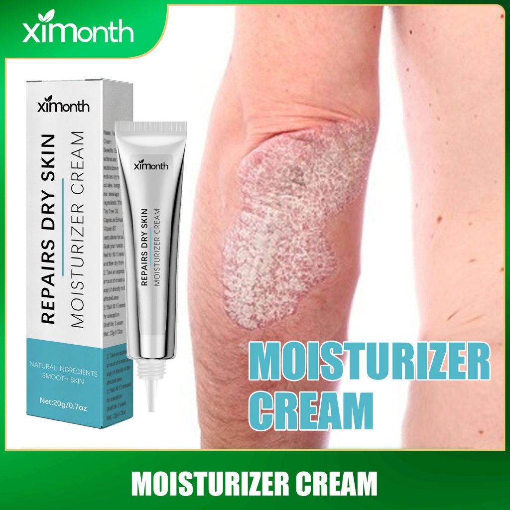 Ximonth Nourishing Skin Cream Skin Repair Essence Moisturizing Curing ...