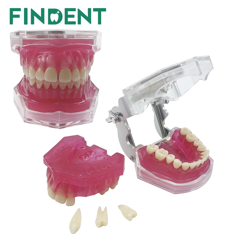 Dental Model Removable Teeth Teaching Model With Soft Gum Tooth For ...