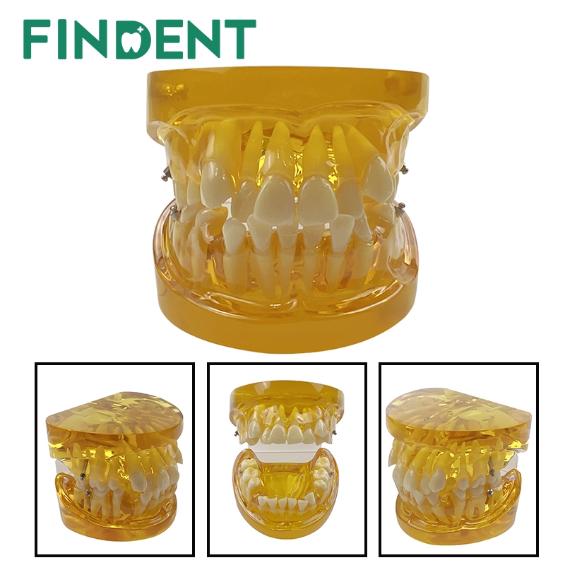 Orange Teeth Resin Model Malocclusion Model Dental Model For Patient ...