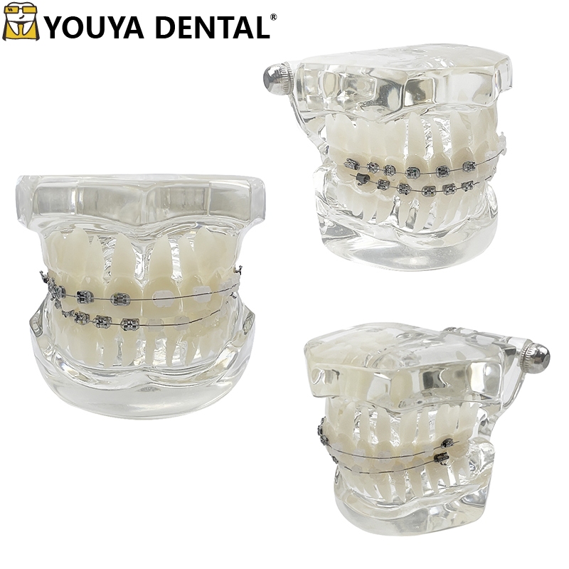 Dentistry Model For Studying Teaching Patient Education Typodont Half ... Dentistry Model For Studying Teaching Patient Education Typodont Half ...