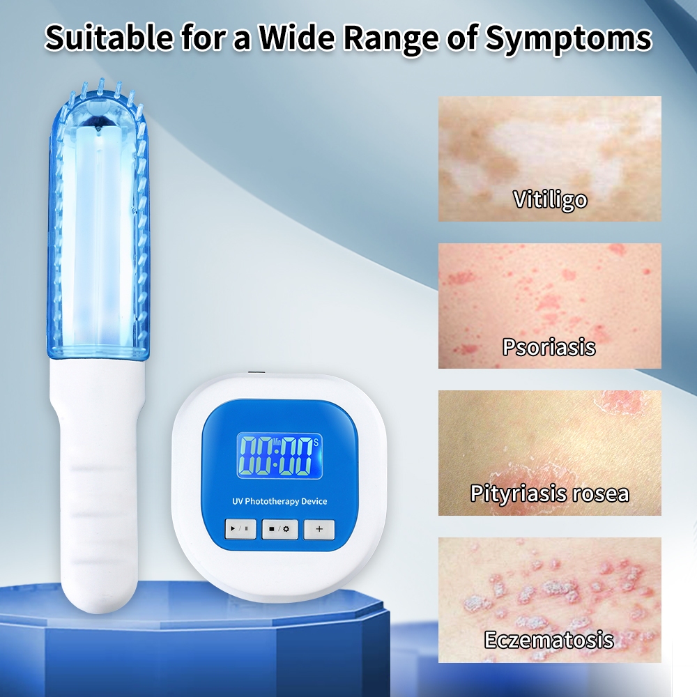 Household 311nm UVB Phototherapy Instrument UV light for Vitiligo ...