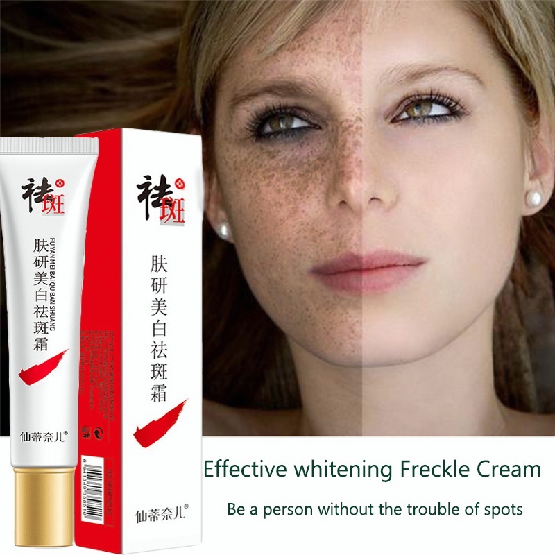 Dark Spot Whitening Melasma Remove Cream/Melanin/Remover/Skin Whitening ...