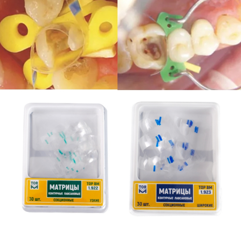 30Pcs/box Dental Transparent Sectional Contoured Matrices Polyester ...