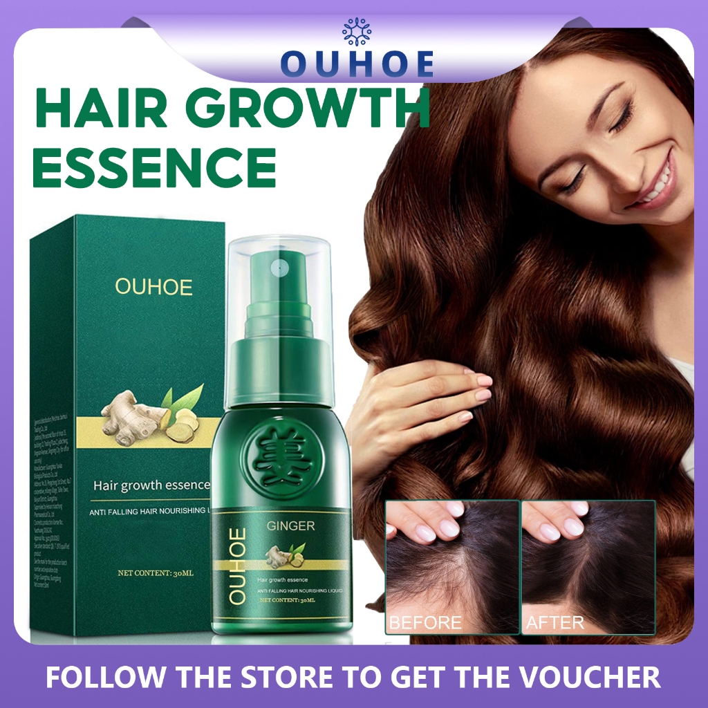 Ouhoe Hair Growth Essence 30ml Ginger Hair Growth Oil Contains Ginseng